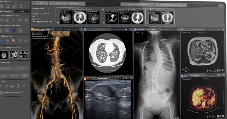 Hérault - À l'issue de son OPA, le groupe Guerbet devient actionnaire ...